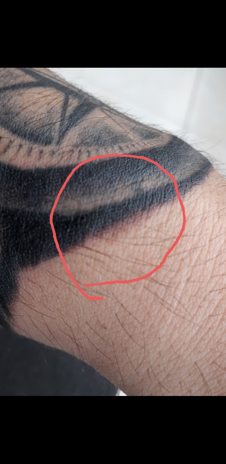 Normal healing or infected? This is day 5 since I had it done. Washed ...